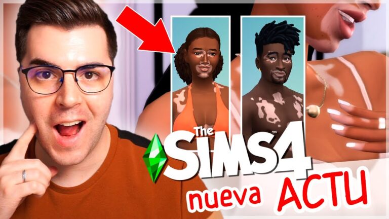 Sims 4: Cómo agregar vitiligo a tus Sims 【2025